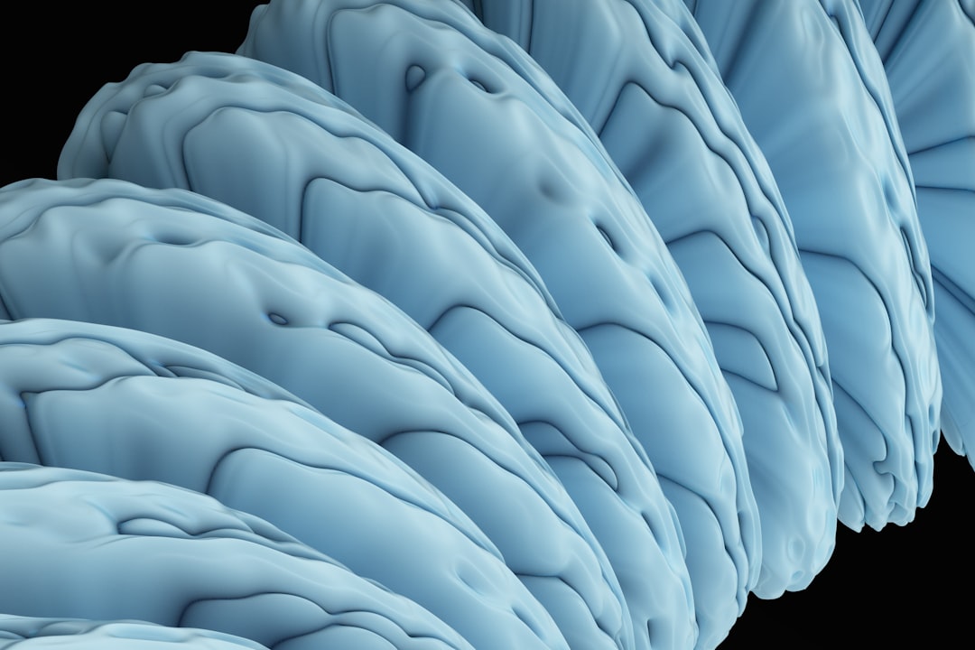 Deja Vu in Temporal Lobe Epilepsy: Understanding the Phenomenon