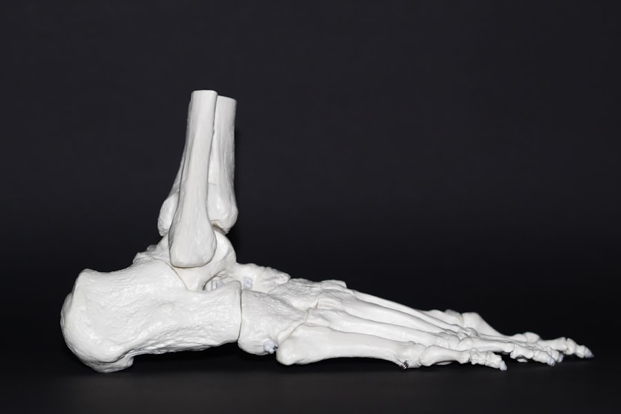 The Connection Between Fawning and Dorsal Collapse